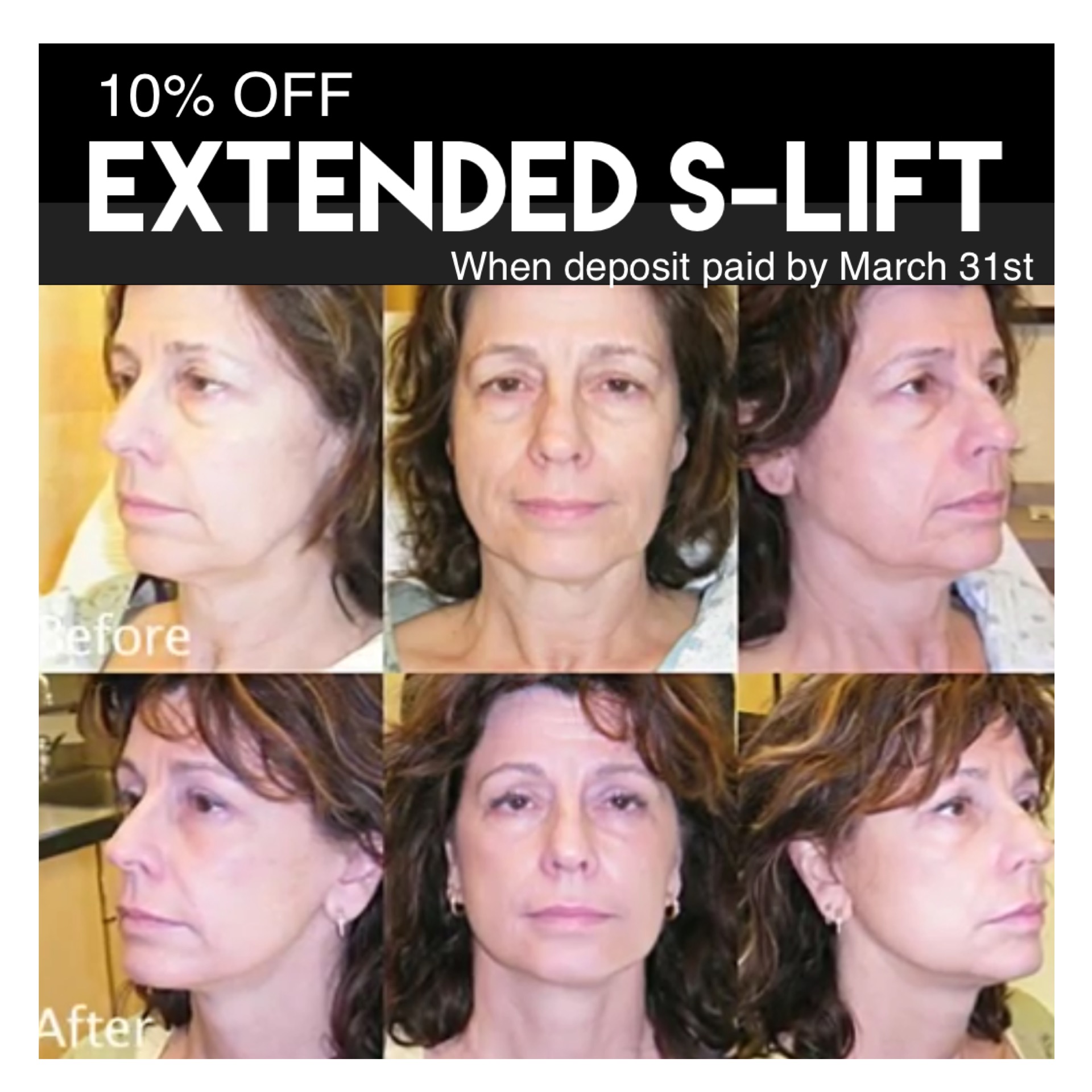 Stay Informed with Aesthetic Surgical Arts News|Eugene, OR|Aesthetic ...